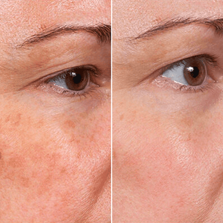 Rejuvenate Resurfacing Face Serum – inblair